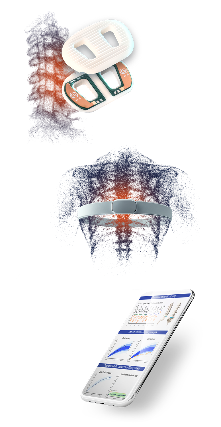 OrthoSens – Making Implants Talk